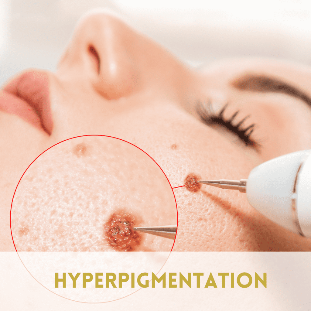 Face – ALPS Aesthetic Centre